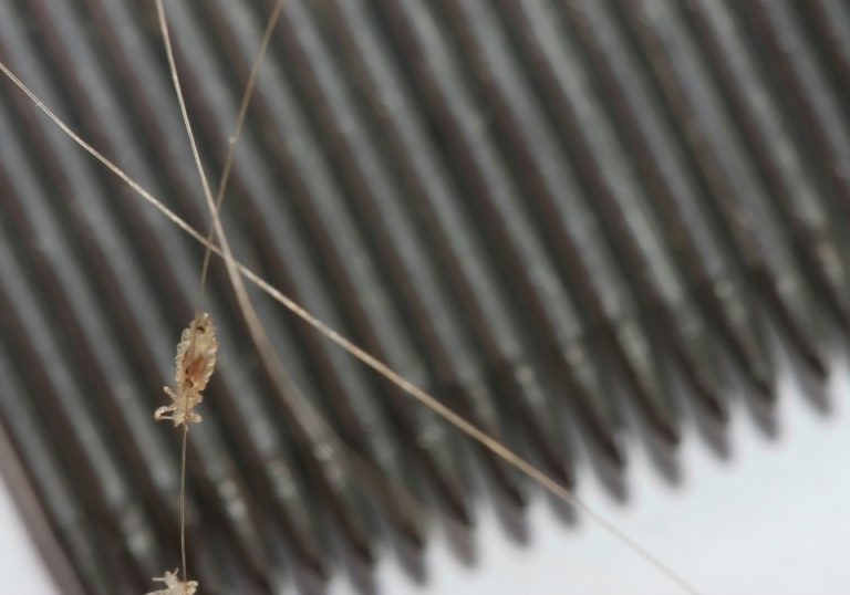 Tips And Tricks On How To Keep Head Lice At Bay